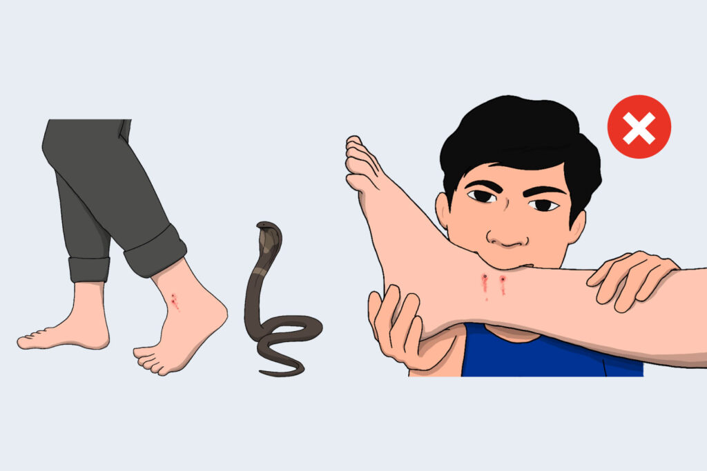 First Aid For Snake Bite - Vitalfour Medical