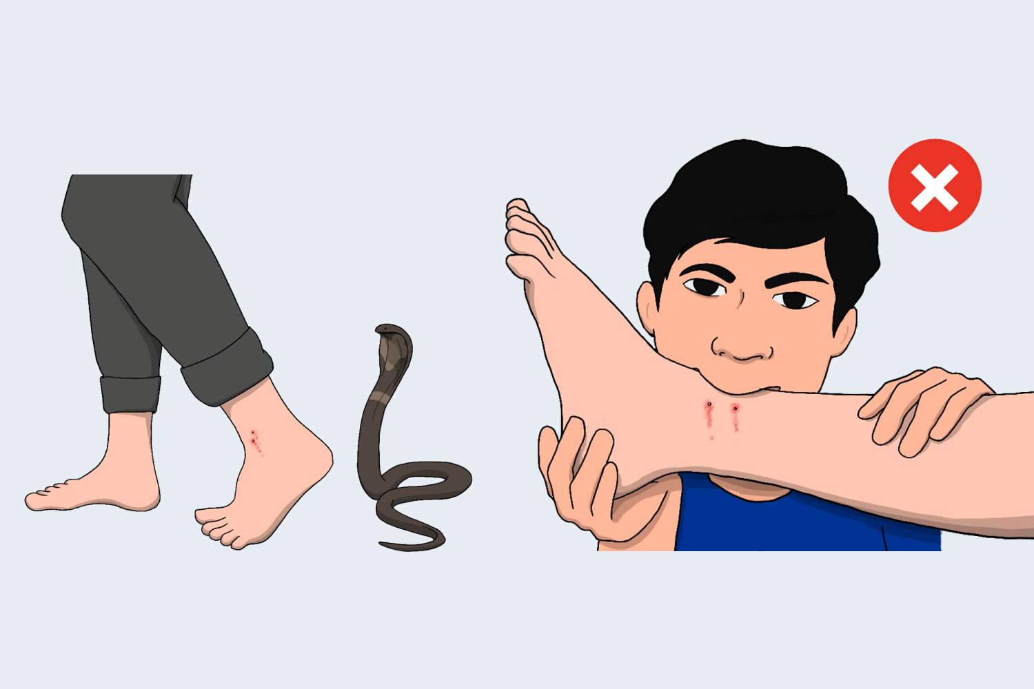 First Aid For Snake Bite - Vitalfour Medical