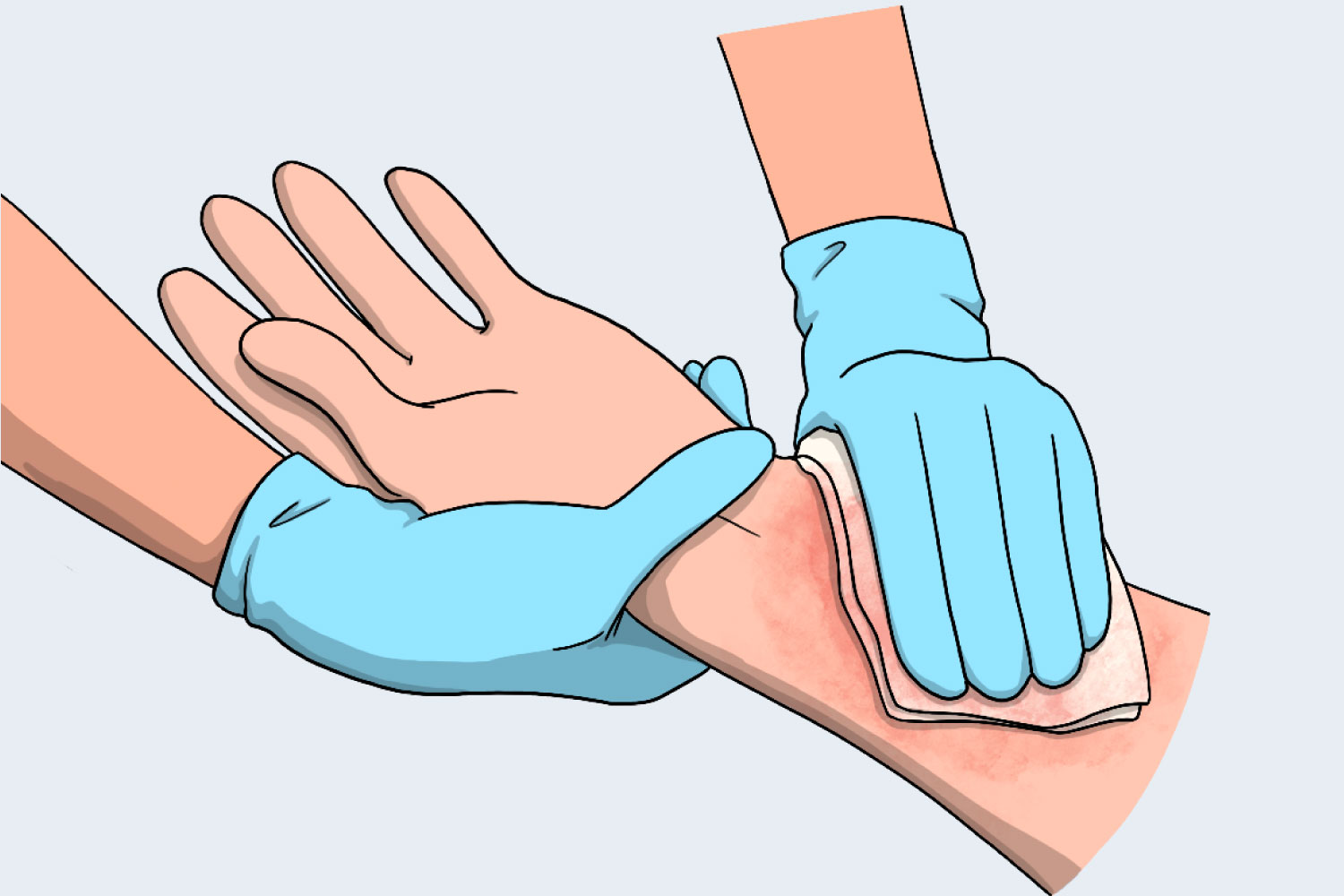 First Aid For Bleeding - Vitalfour Medical
