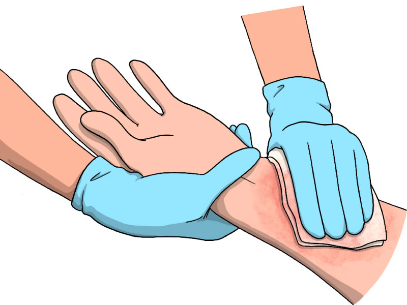 First Aid For Bleeding - Vitalfour Medical